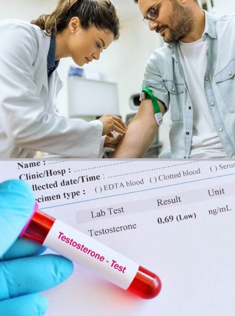 Total Testosterone vs. Free Testosterone | What's the Difference?